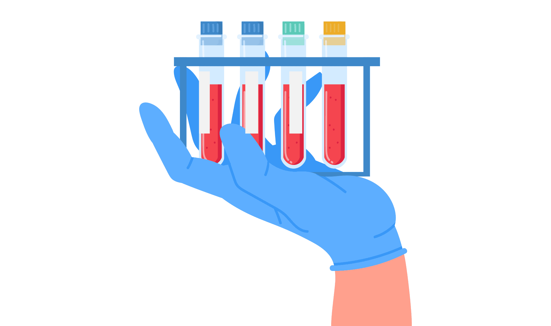 Afib Tests – PCNA Atrial Fibrillation